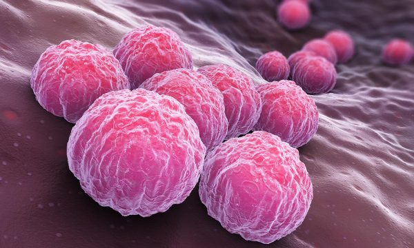 Causes And Symptoms Of Chlamydial Conjunctivitis | Genetrack Biolabs