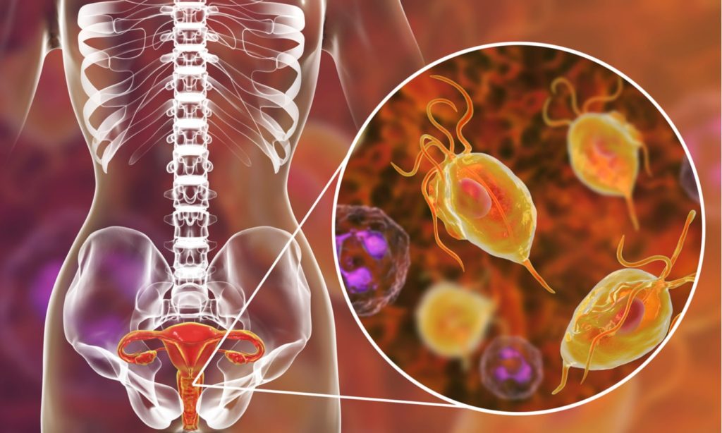 Trichomoniasis Quick Facts | Genetrack Biolabs